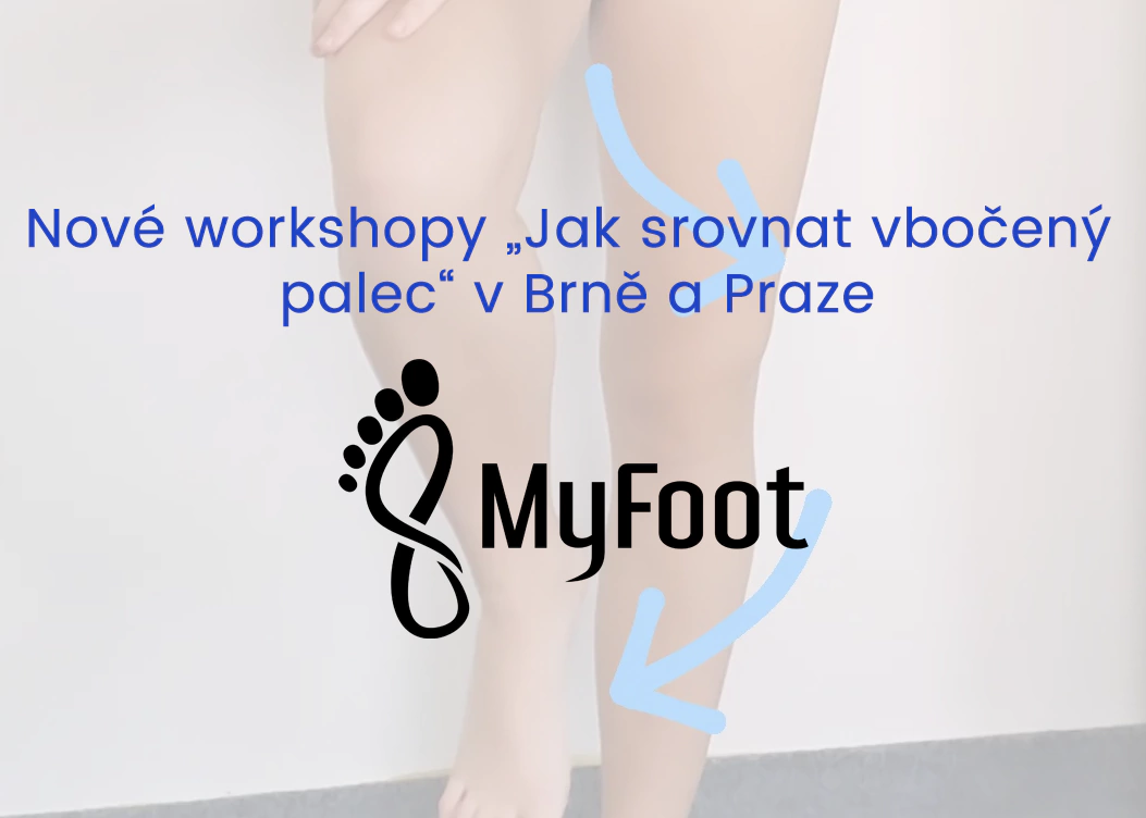 Jak srovnat vbočený palec přes kyčelní kloub » myfoot.cz
